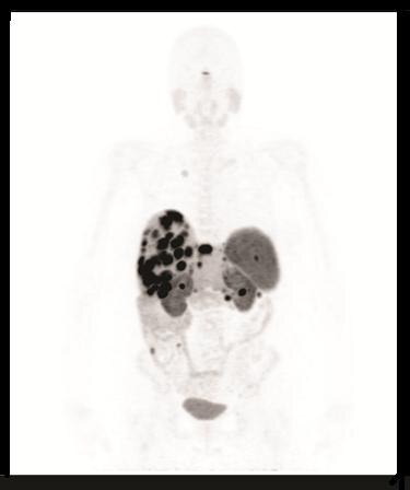 PET Radiopharmacy | GE Healthcare (Turkey)