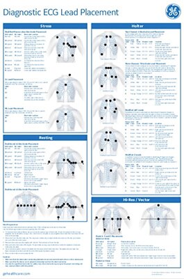 Tanısal EKG | GE Healthcare (Turkey)