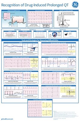 Tanısal EKG | GE Healthcare (Turkey)