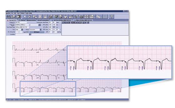 Kardiyoloji Veri Yönetimi | GE Healthcare (Turkey)