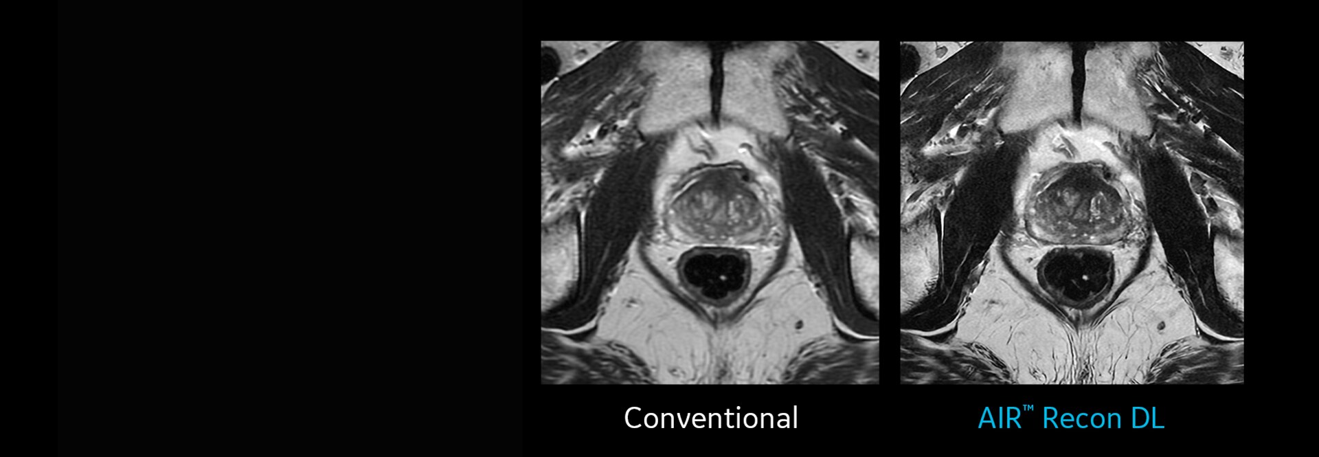 BodyWorks| GE Healthcare (Turkey)