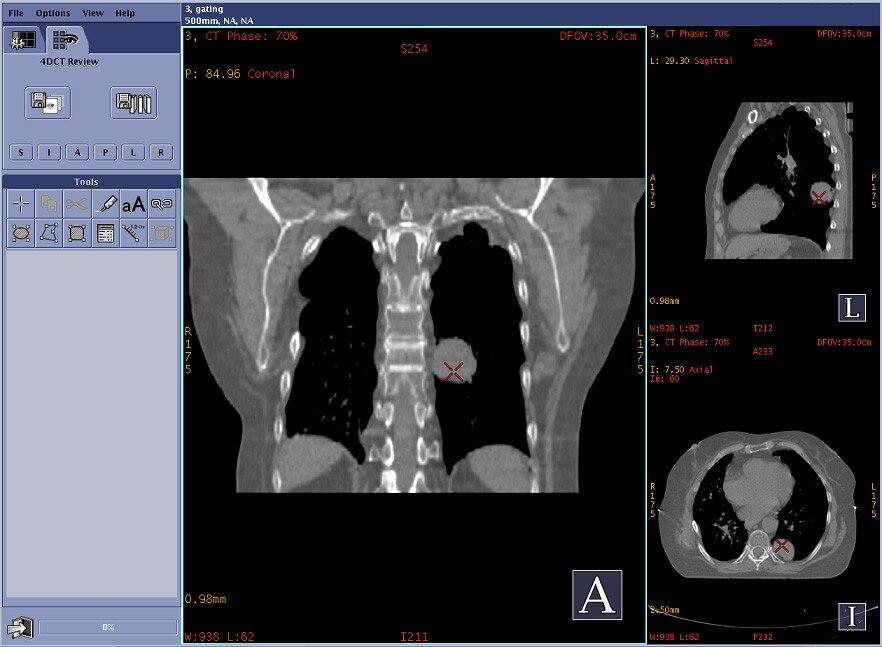Advantage 4D | GE Healthcare (Turkey)