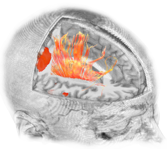 BrainWave | GE HealthCare (Turkey)