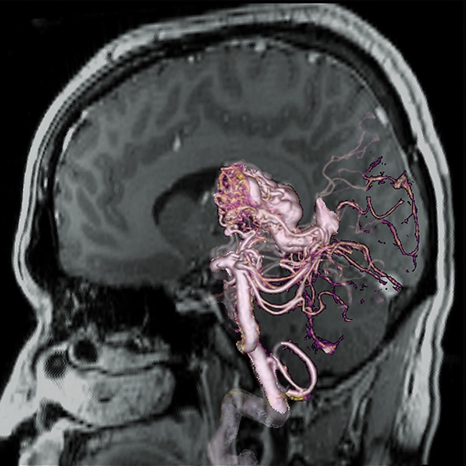 Innova CT HD | GE Healthcare (Turkey)