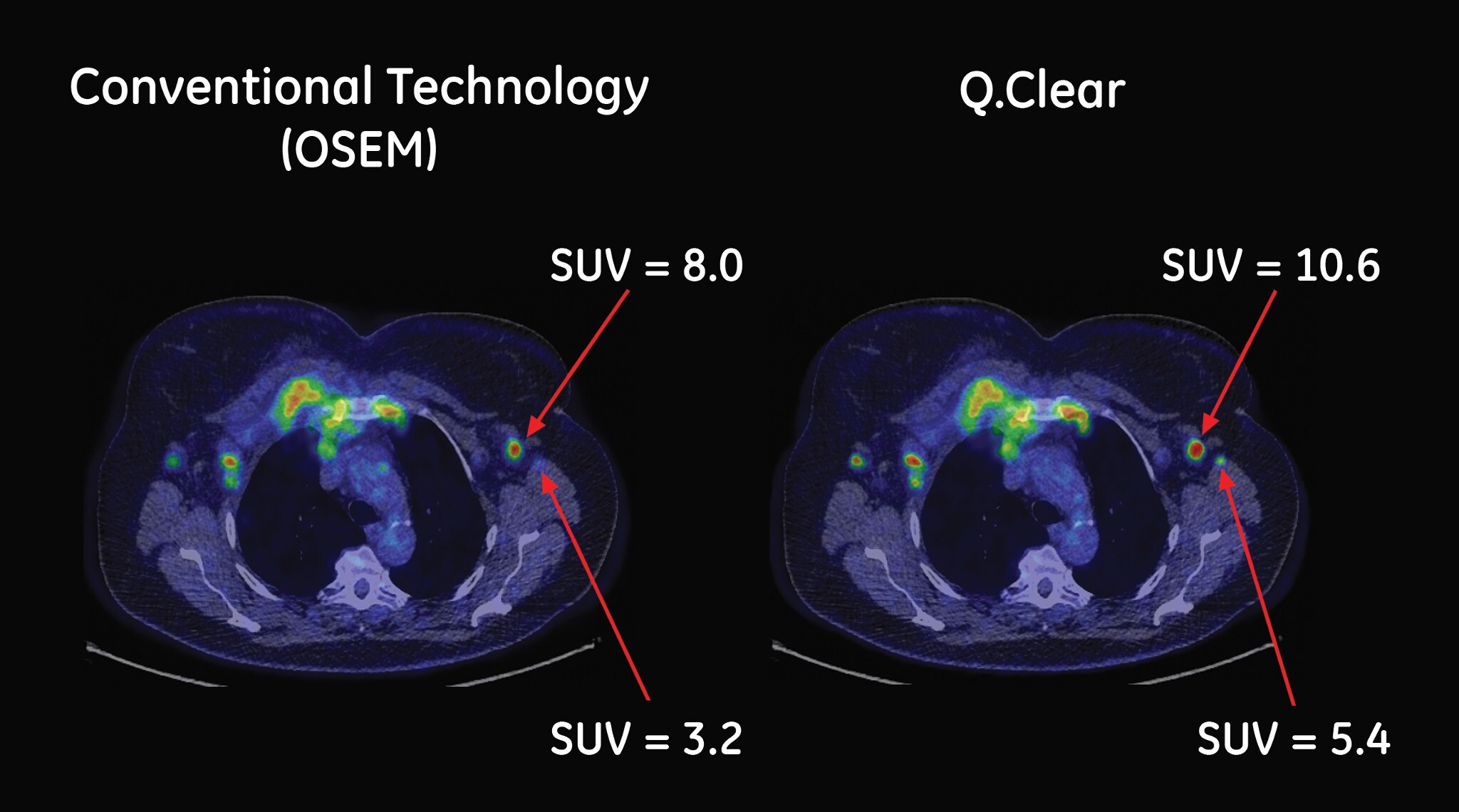 QClear | GE Healthcare (Turkey)
